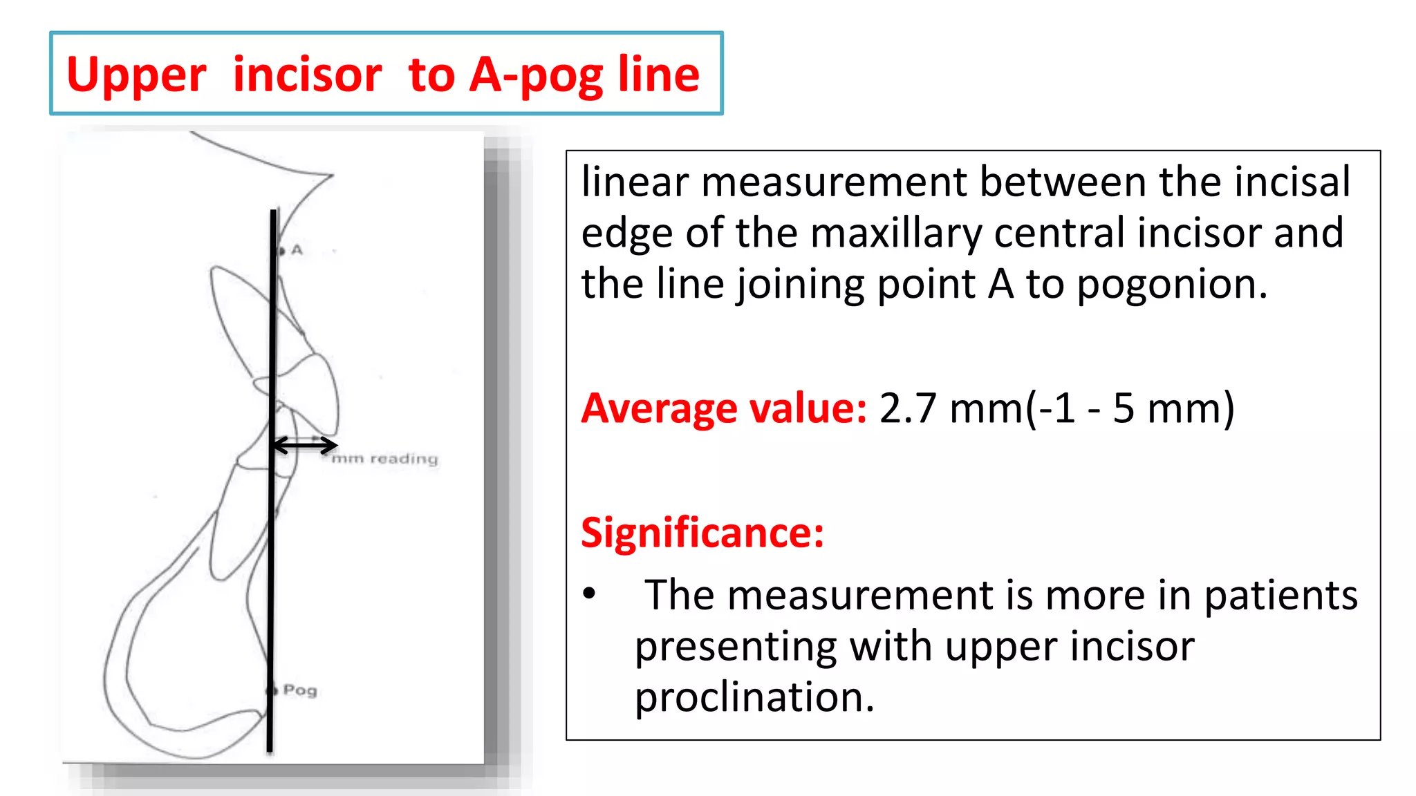 Cephalometrics | PPTX