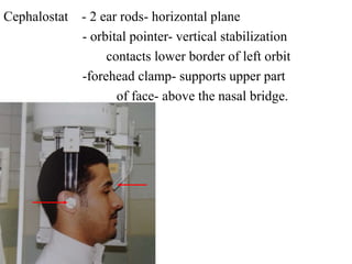 CEPHALOMETRICS(Dr.ASWIN) | PPT