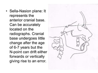 CEPHALOMETRICS.ppt A Scientific approach to the scrutiny of human ...