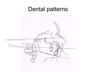 CEPHALOMETRICS.ppt A Scientific approach to the scrutiny of human ...