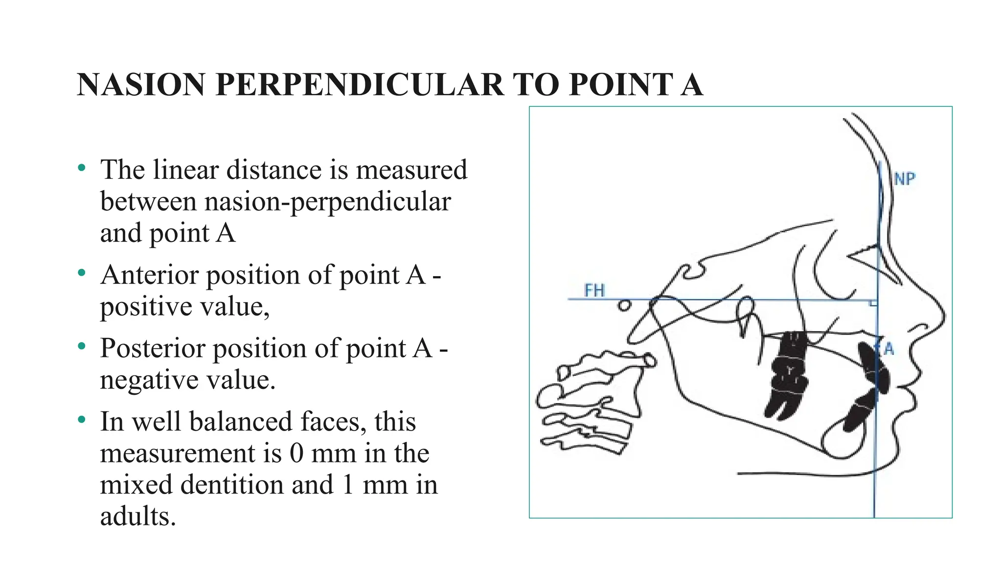 Cephalometrics analysis in orthodontics.pptx