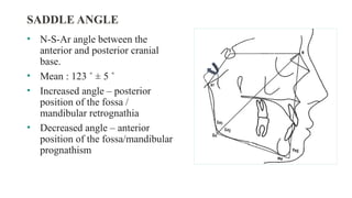 Cephalometrics analysis in orthodontics.pptx