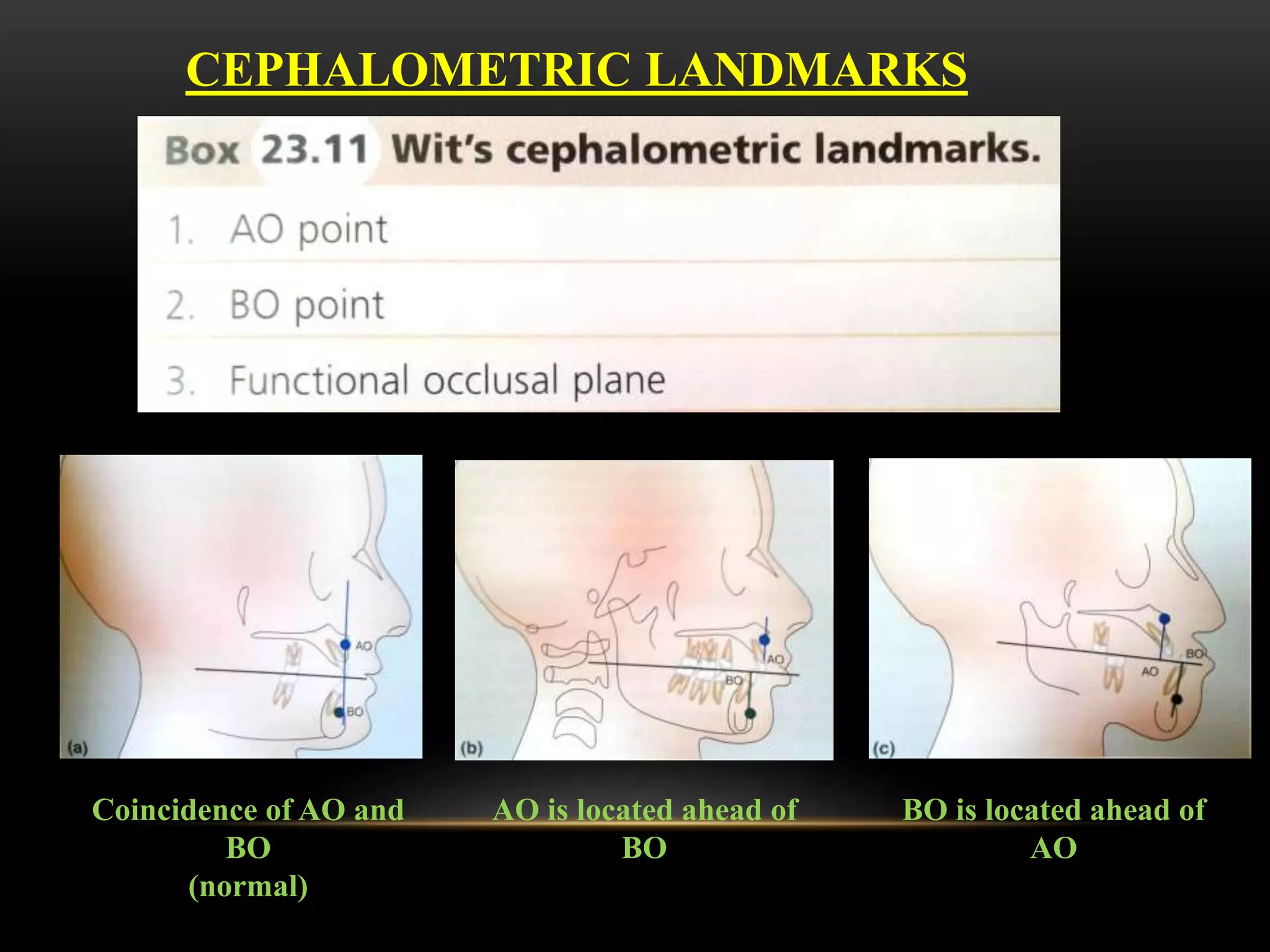 Cephalometrics 2 | PPT