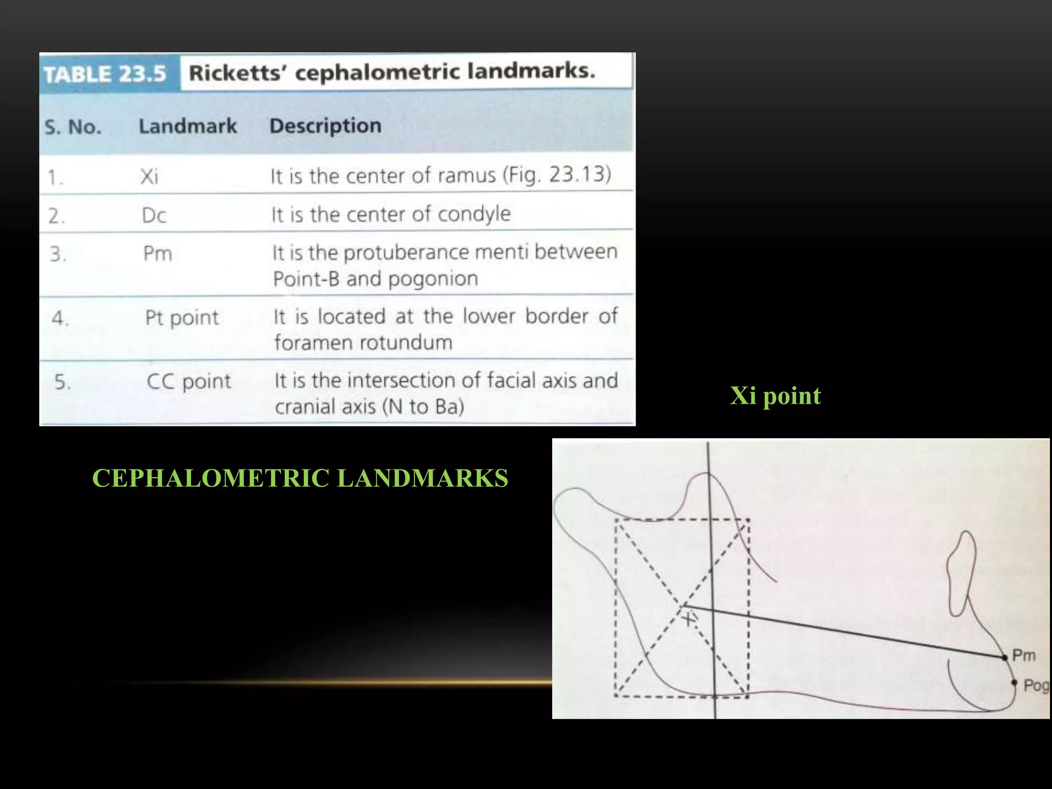 Cephalometrics 2 | PPT