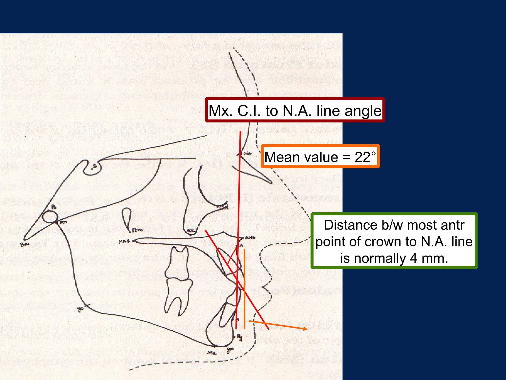 Cephalometrics (2).pptxjbjbliknklbkj , kjmkl | PPT