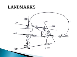 Cephalometrics, diagnostic tool | PPTX