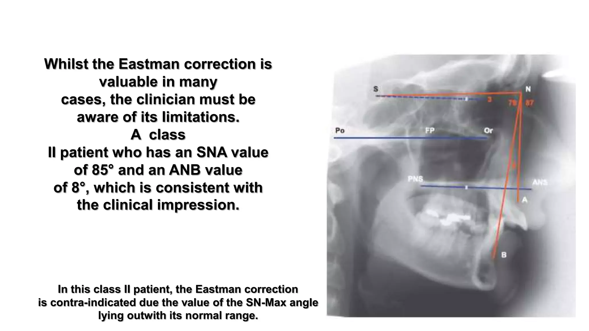 Cephalometrics for orthognathic surgery part 2 | PPTX