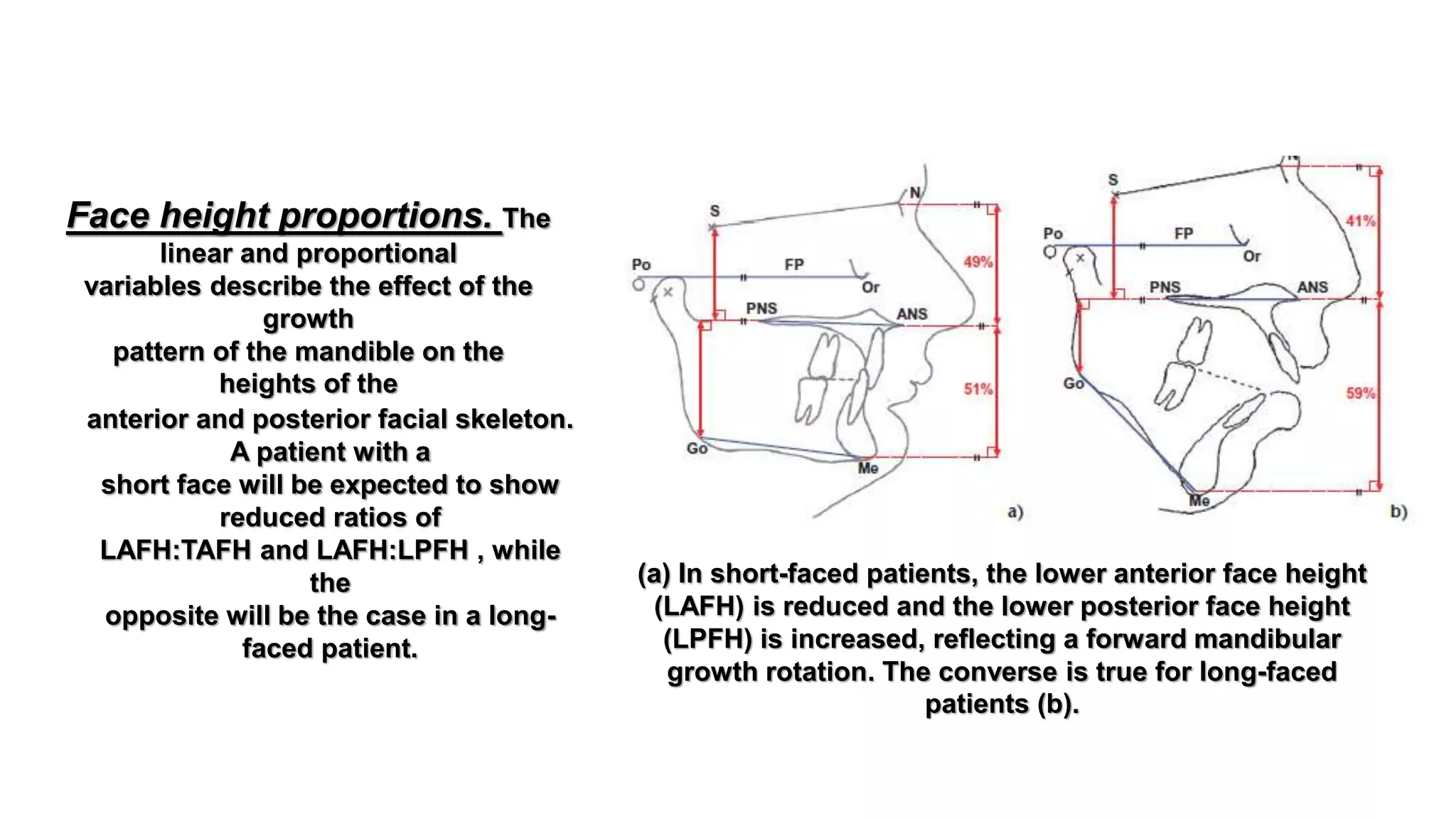 Cephalometrics for orthognathic surgery part 2 | PPTX