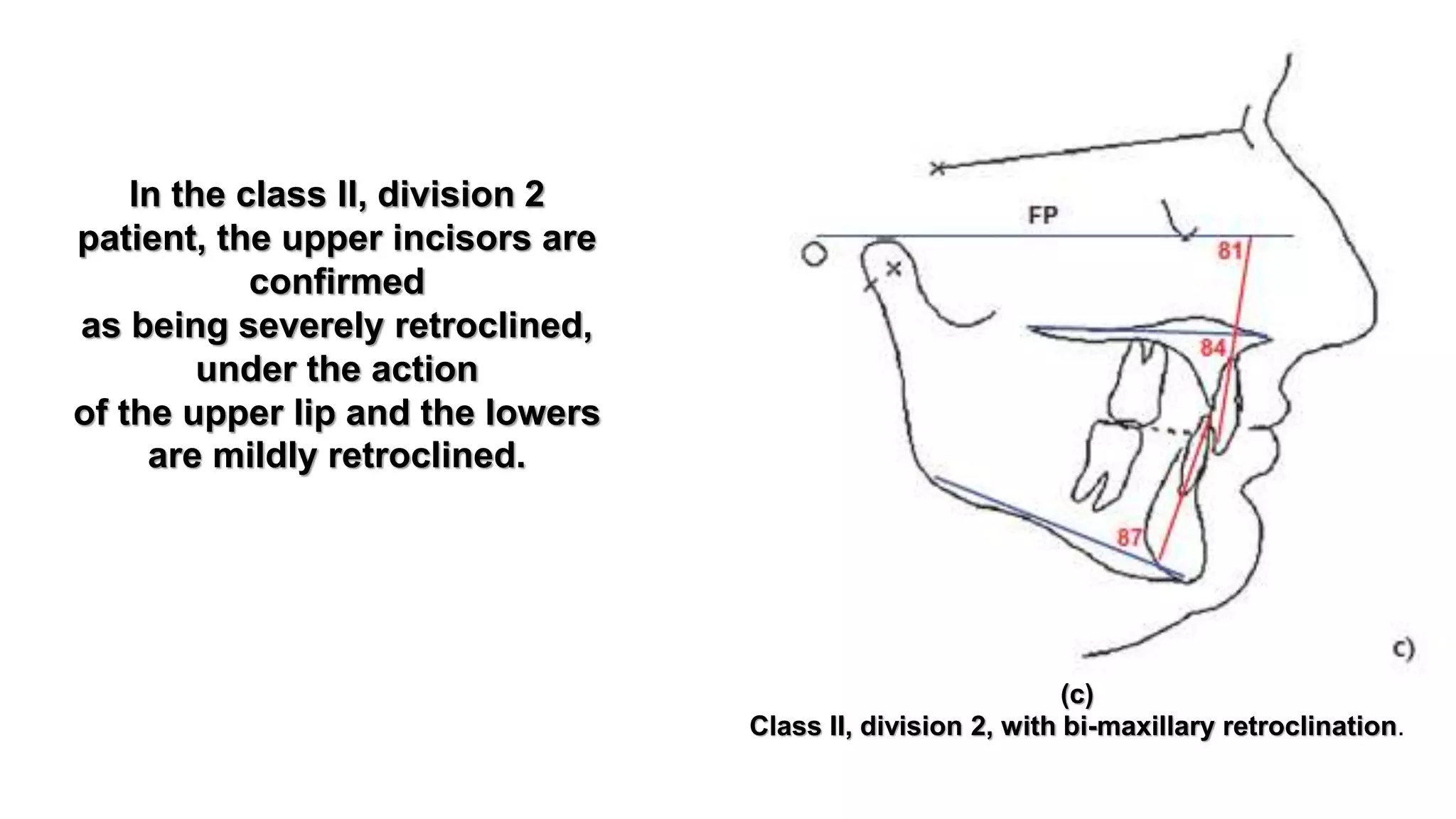 Cephalometrics for orthognathic surgery part 2 | PPTX