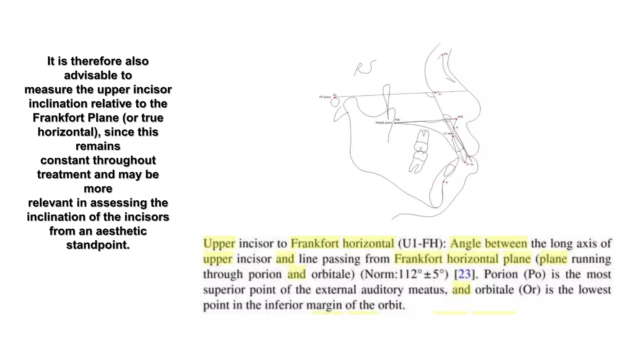 Cephalometrics for orthognathic surgery part 2 | PPTX