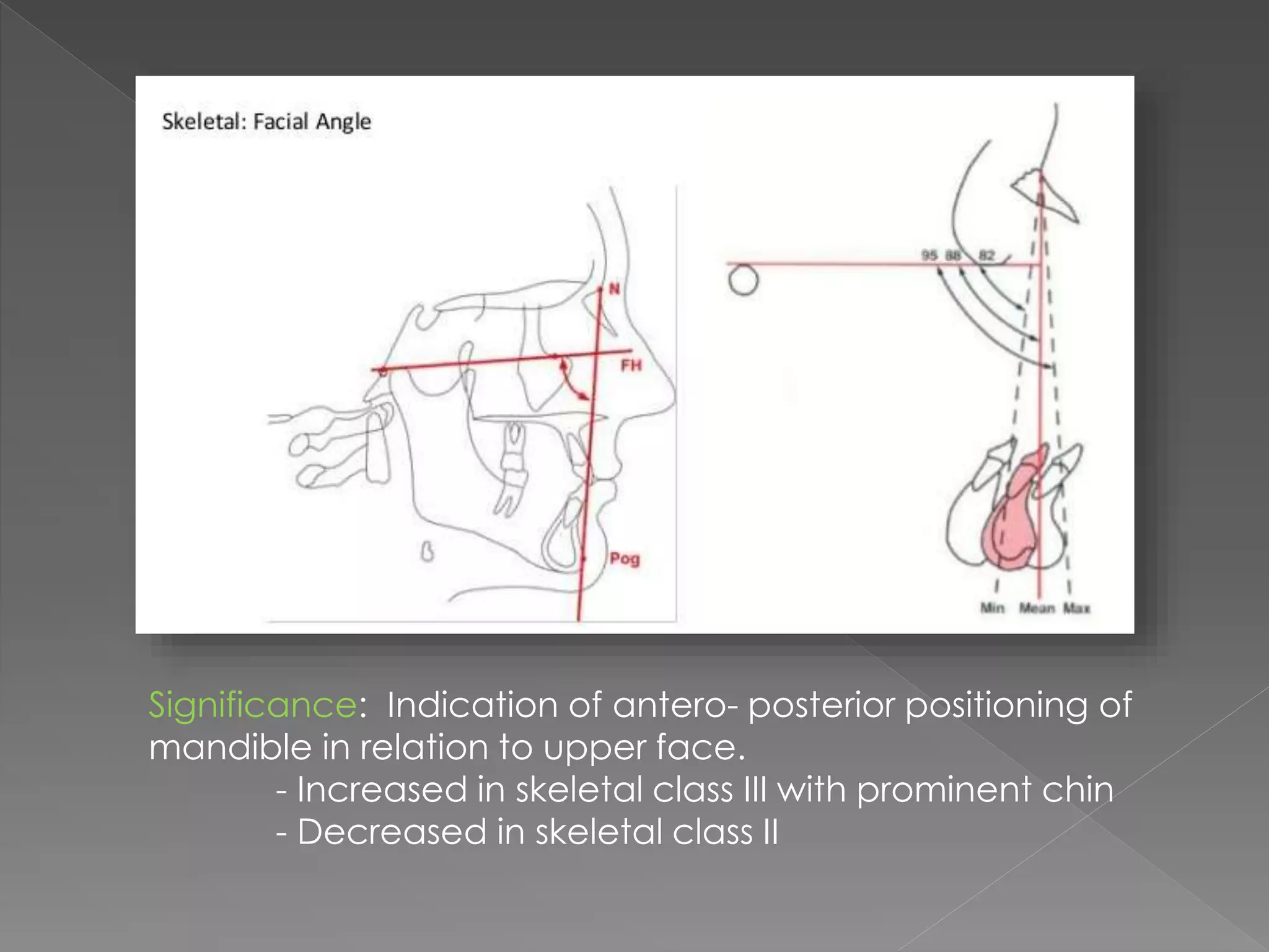 Cephalometrics in orthodontics | PPTX