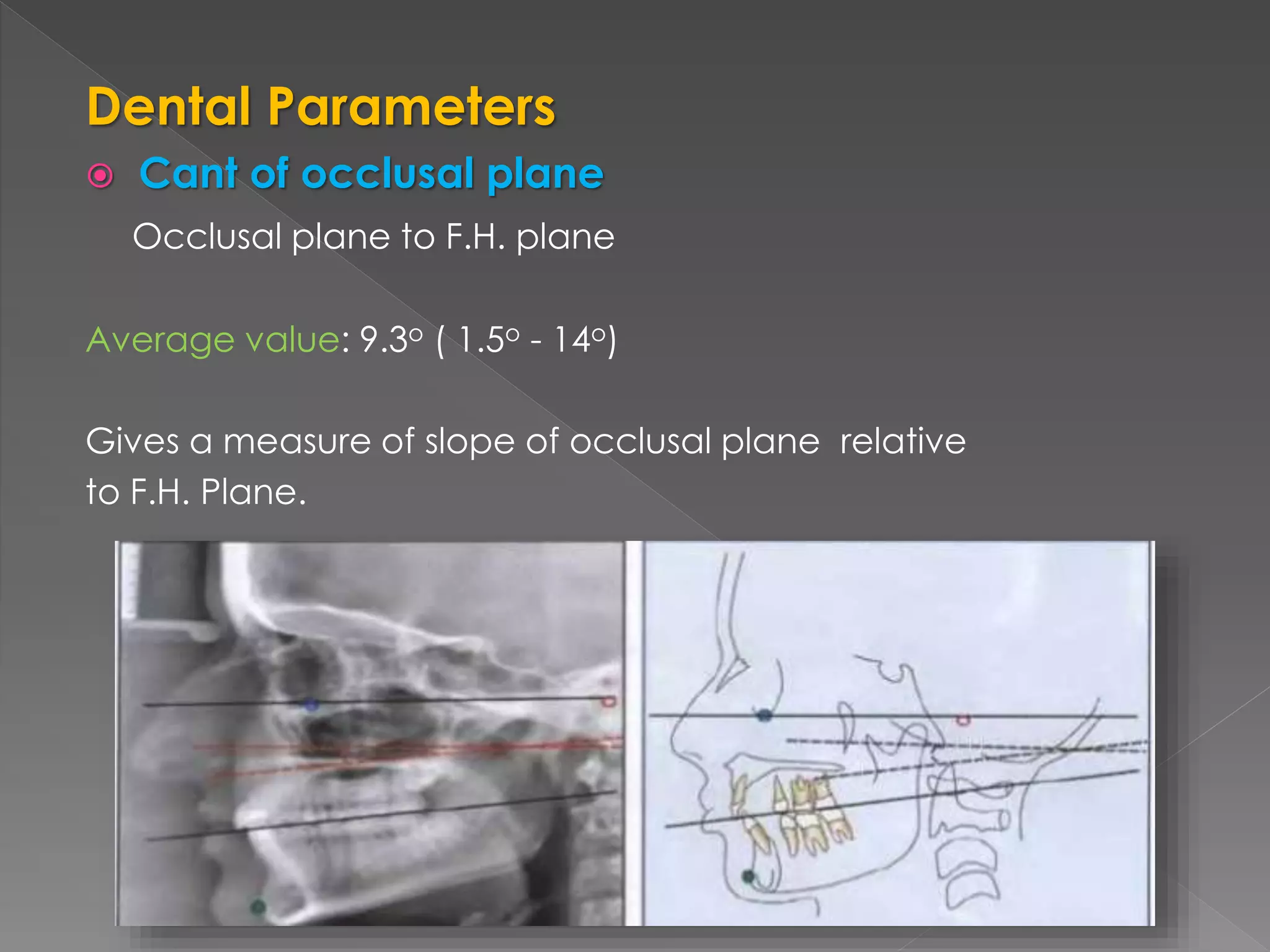 Cephalometrics in orthodontics | PPTX