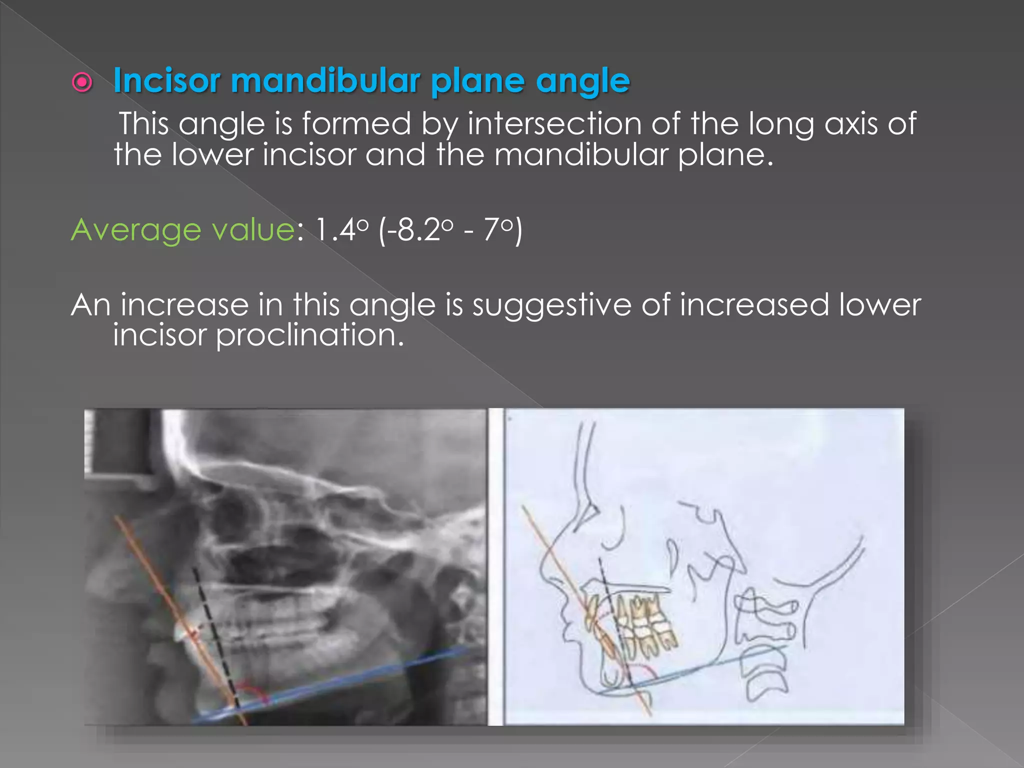 Cephalometrics in orthodontics | PPTX