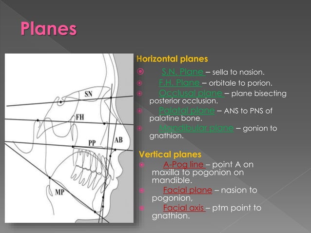 Cephalometrics in orthodontics | PPTX | Dental Health | Diseases and ...