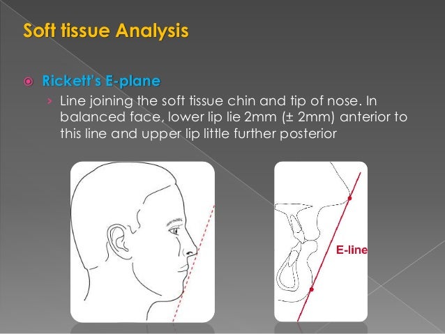 Cephalometrics in orthodontics