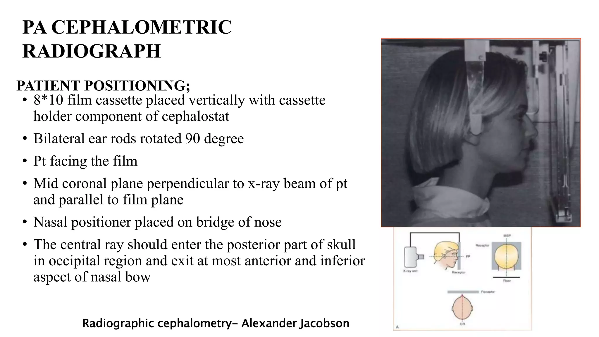 Cephalometrics analysis | PPTX