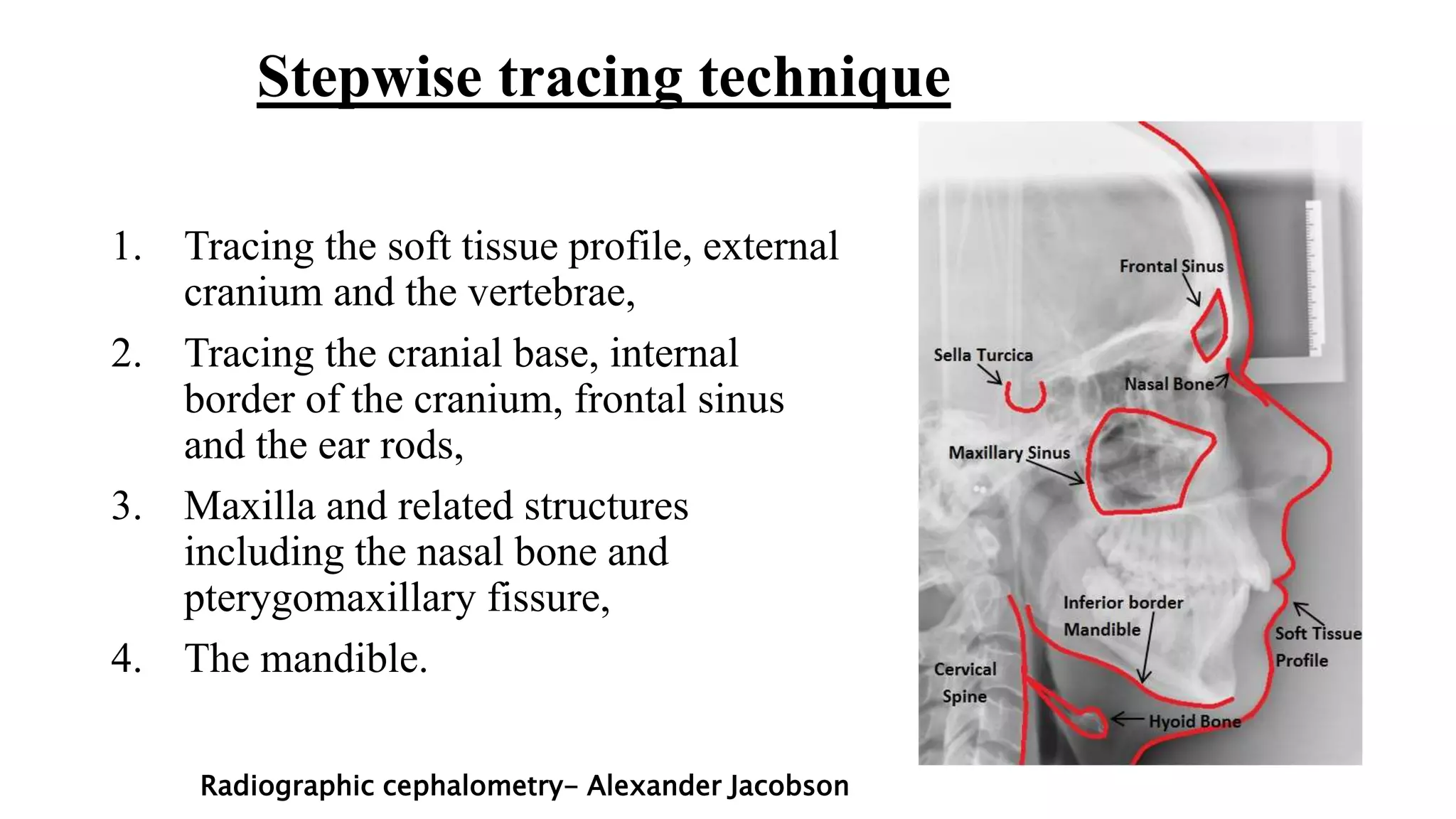 Cephalometrics analysis | PPTX