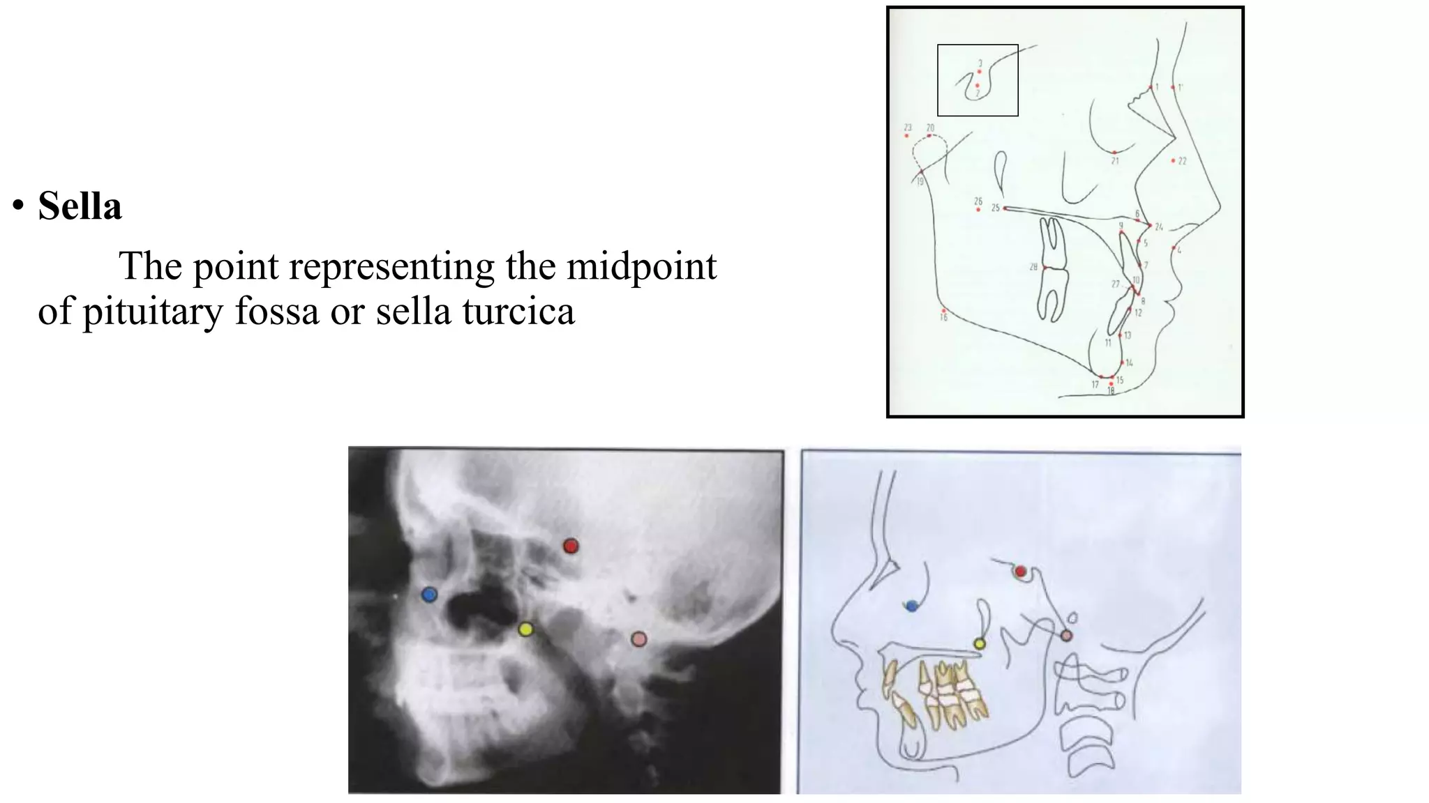 Cephalometrics analysis | PPTX