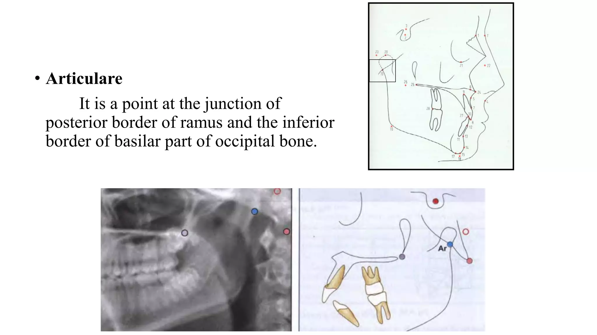 Cephalometrics analysis | PPTX
