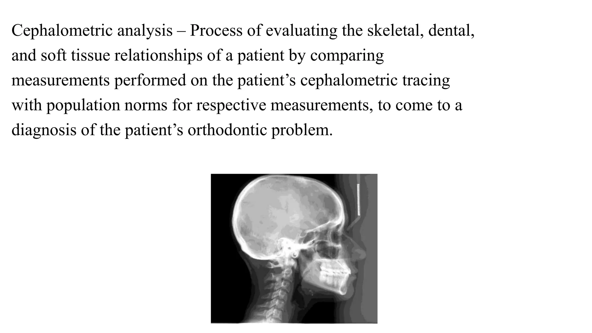 Cephalometrics analysis | PPTX