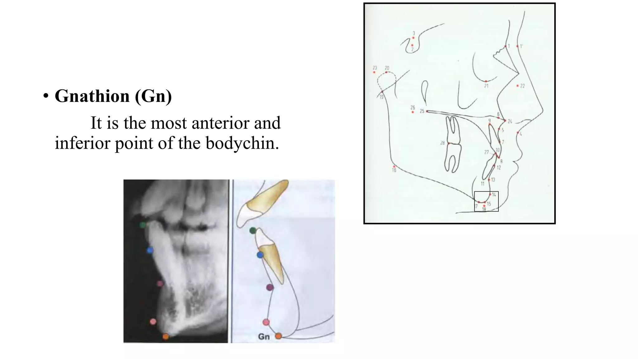 Cephalometrics analysis | PPTX