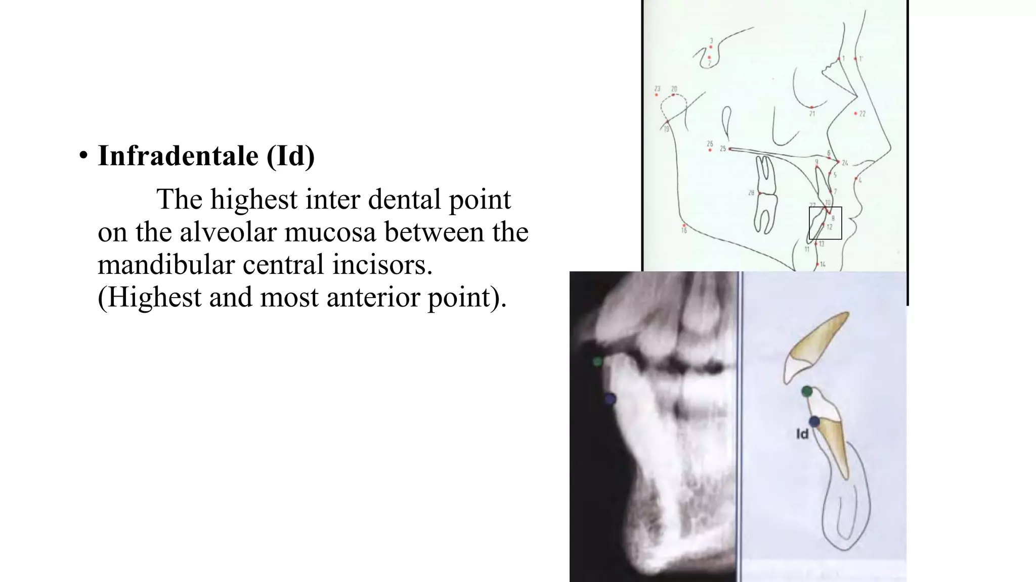 Cephalometrics analysis | PPTX