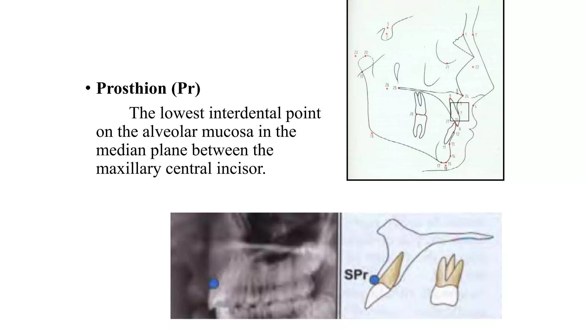 Cephalometrics analysis | PPTX