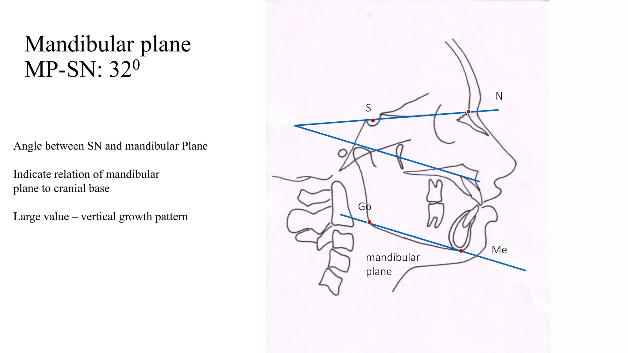 Cephalometrics analysis | PPTX