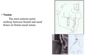 Cephalometrics analysis | PPTX