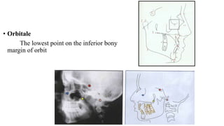 Cephalometrics analysis | PPTX