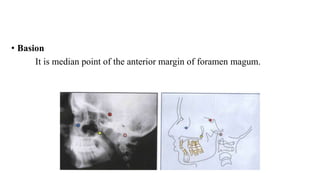 Cephalometrics analysis | PPTX