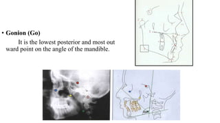 Cephalometrics analysis | PPTX