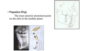 Cephalometrics analysis | PPTX