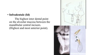Cephalometrics analysis | PPTX