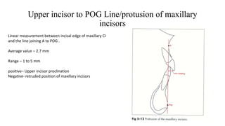 Cephalometrics analysis | PPTX