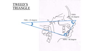 Cephalometrics analysis | PPTX