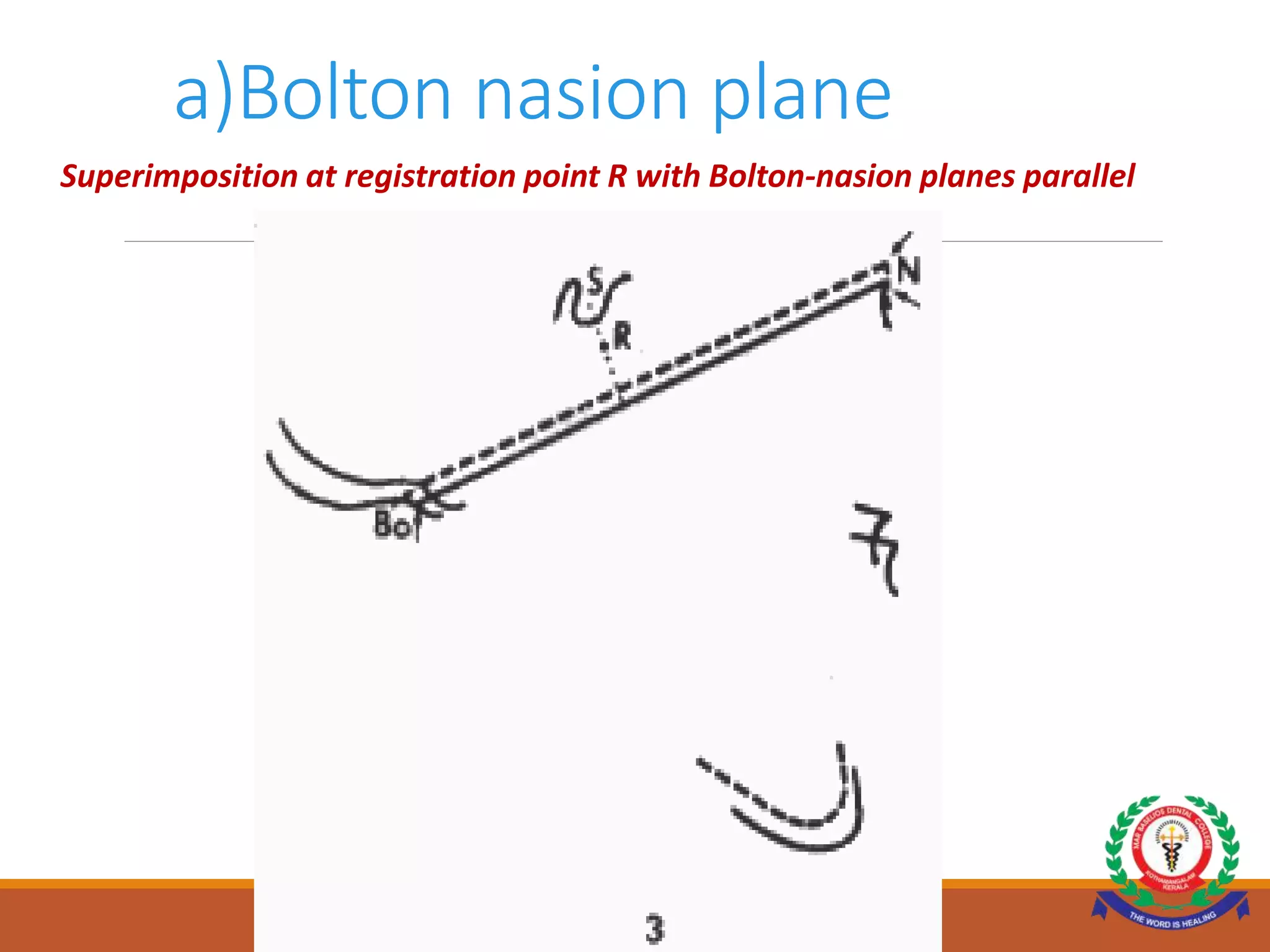 CEPHALOMETRIC SUPERIMPOSITION.ppt