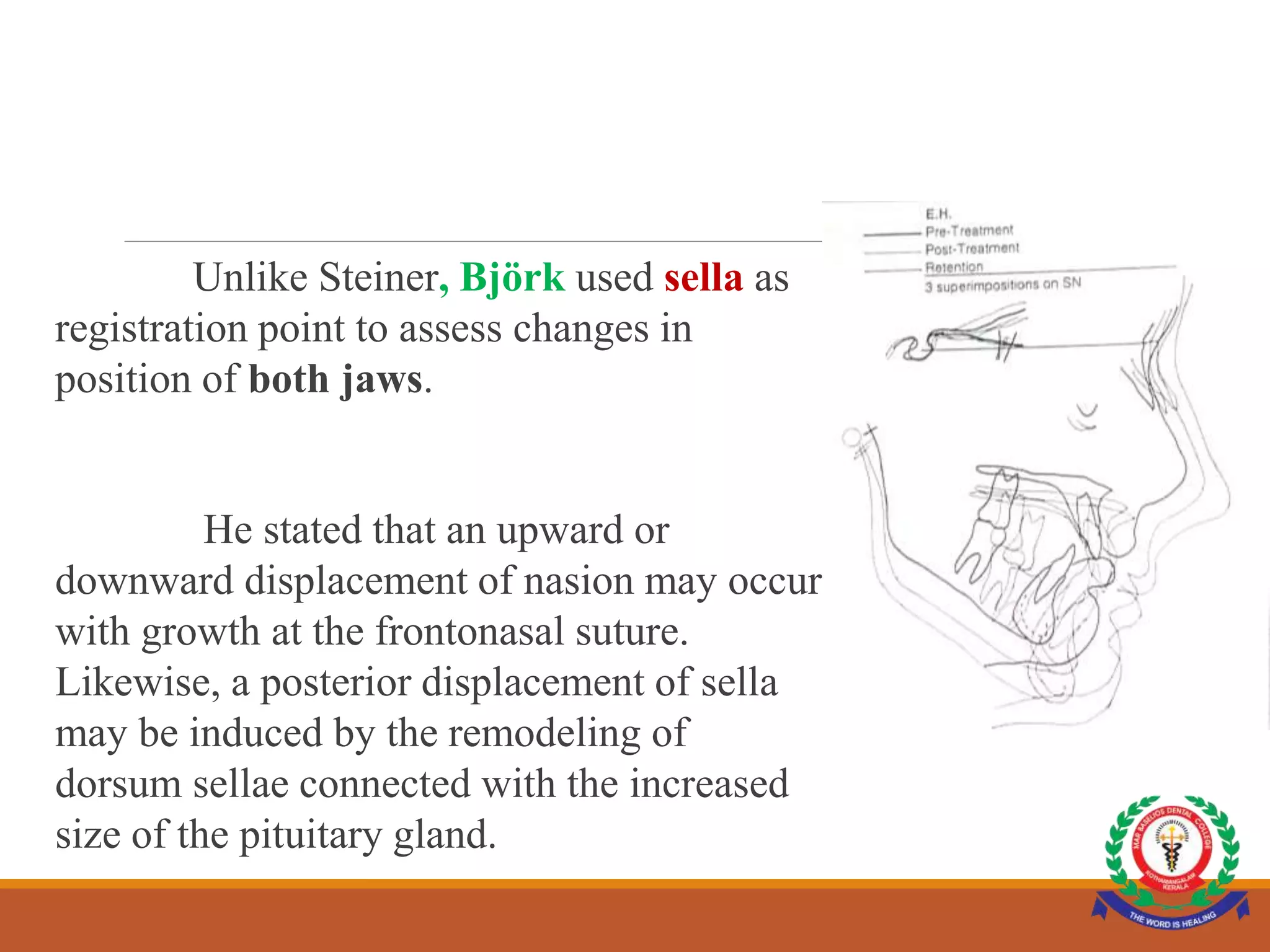 CEPHALOMETRIC SUPERIMPOSITION.ppt