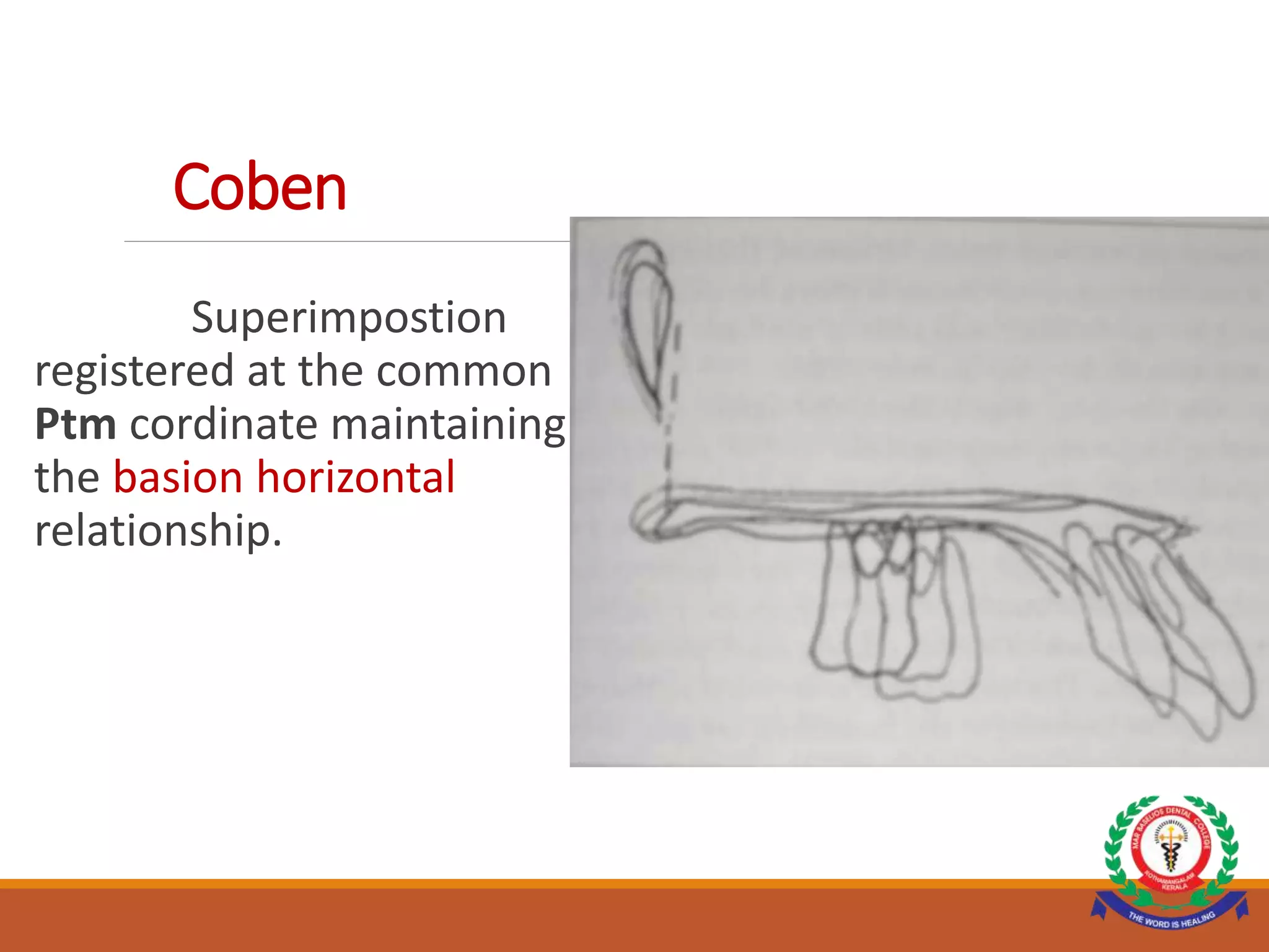 CEPHALOMETRIC SUPERIMPOSITION.ppt