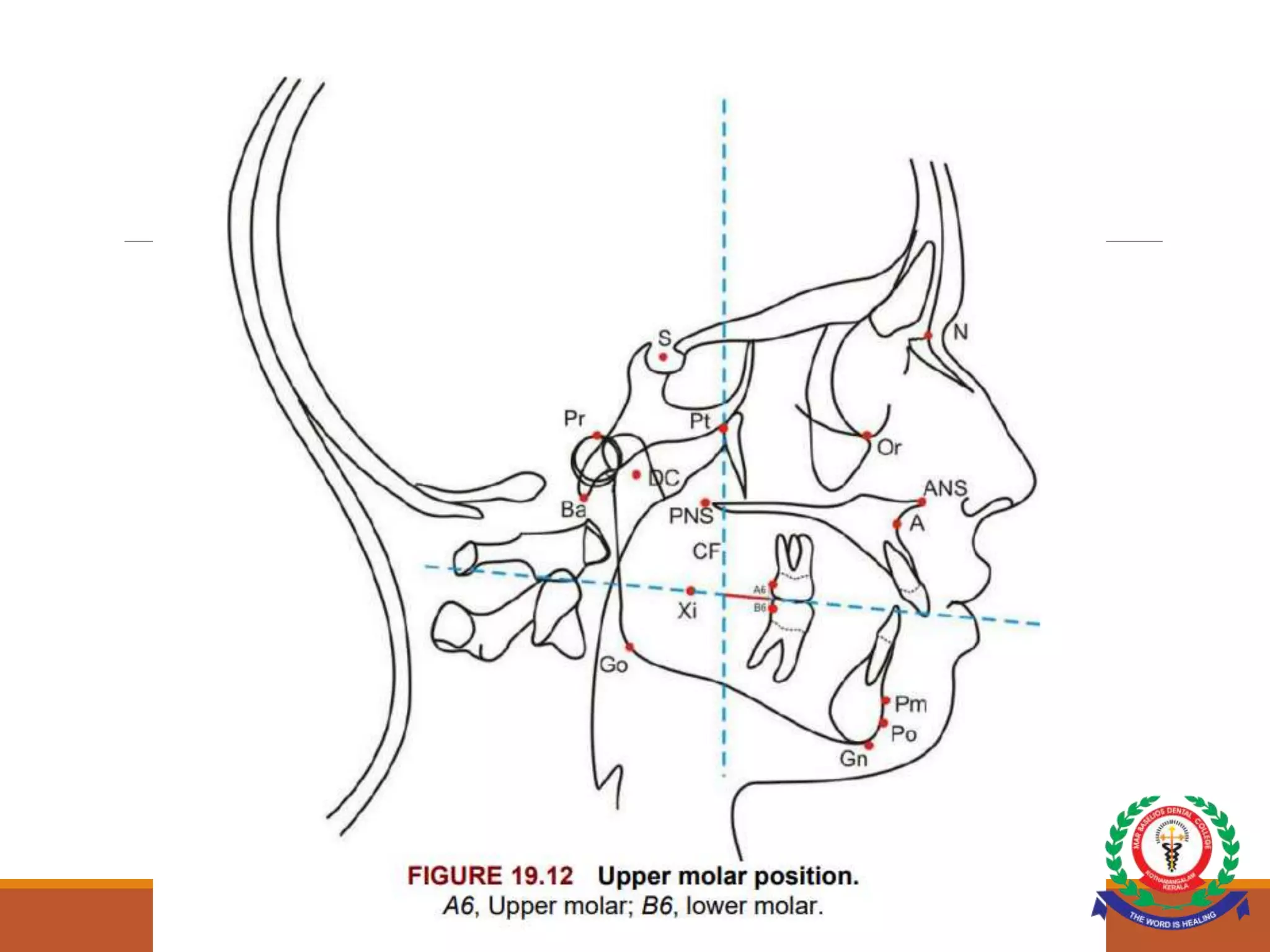 CEPHALOMETRIC SUPERIMPOSITION.ppt