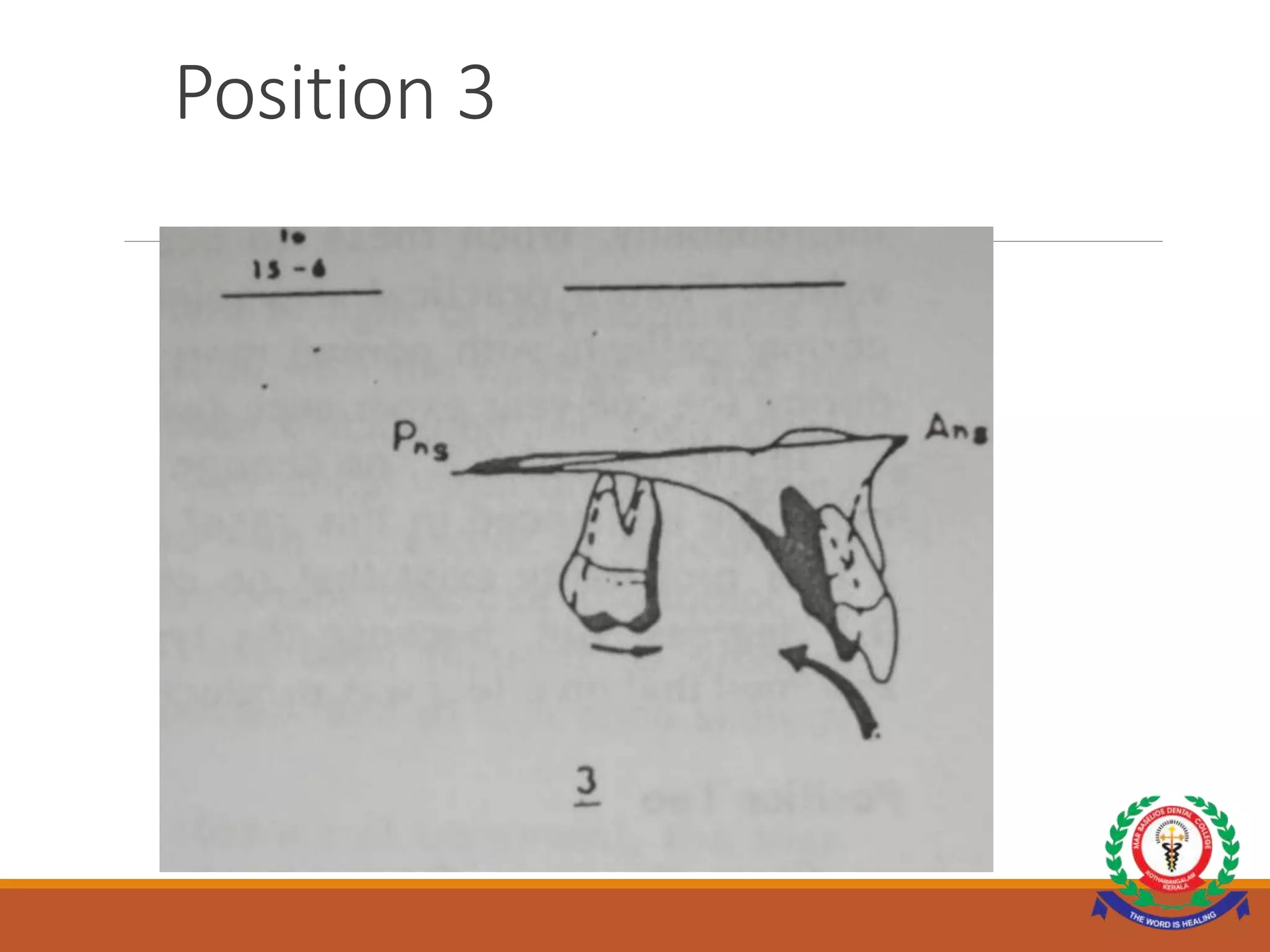 CEPHALOMETRIC SUPERIMPOSITION.ppt