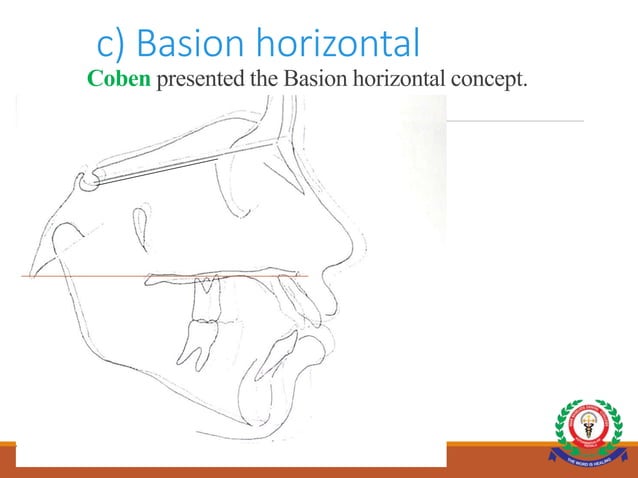 CEPHALOMETRIC SUPERIMPOSITION.ppt | Dental Health | Diseases and Conditions