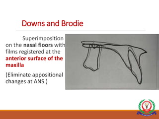 CEPHALOMETRIC SUPERIMPOSITION.ppt