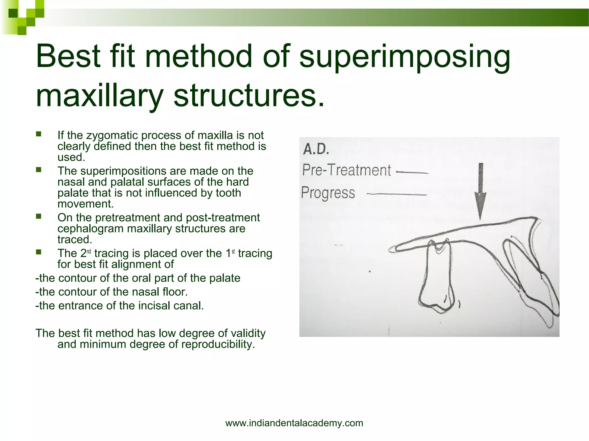 Cephalometric superimposition methods | PPT