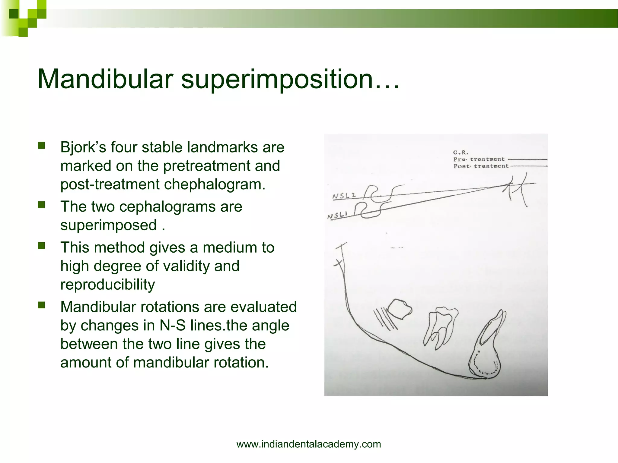 Cephalometric superimposition methods | PPT
