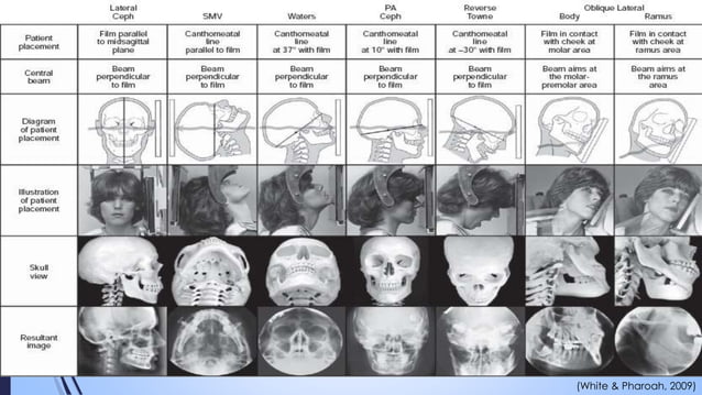 Cephalometry | PPTX