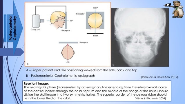 Cephalometry