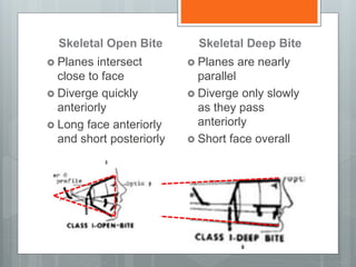 Cephalometry | PPTX