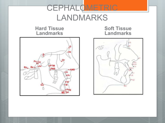 Cephalometry | PPTX