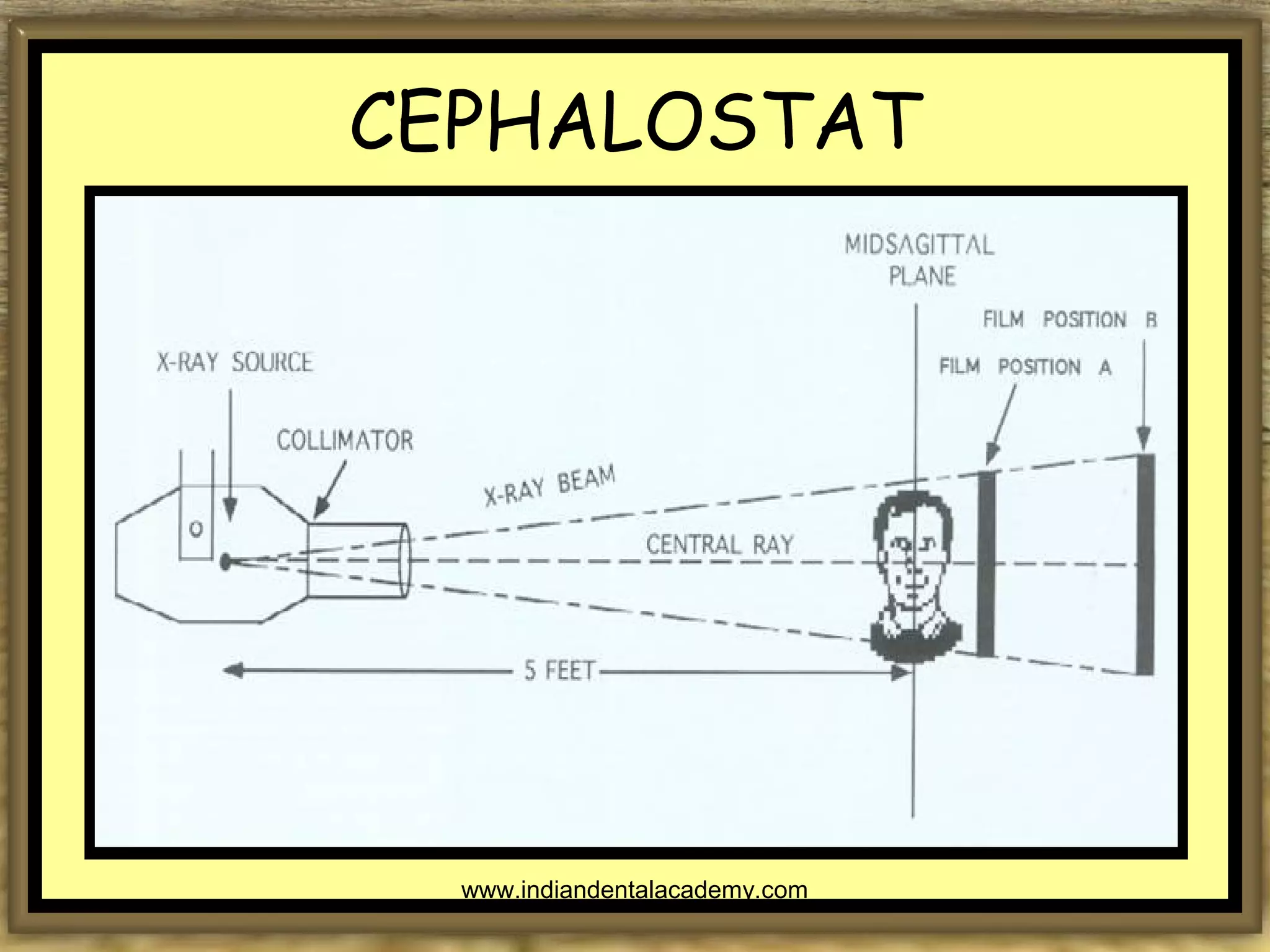 Cephalometry (2) | PPT | Ear, Nose and Throat Conditions | Diseases and ...